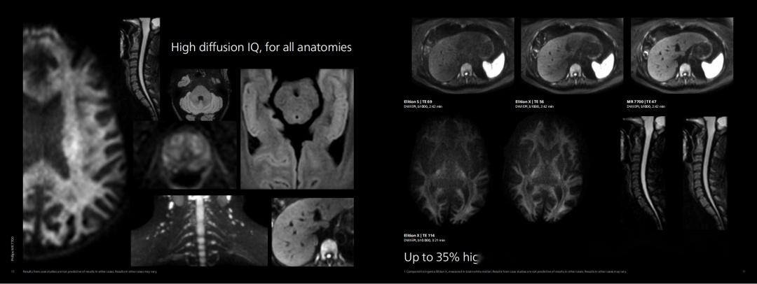 最新！飞利浦磁共振成像系统MR 7700获FDA批准 - 知乎