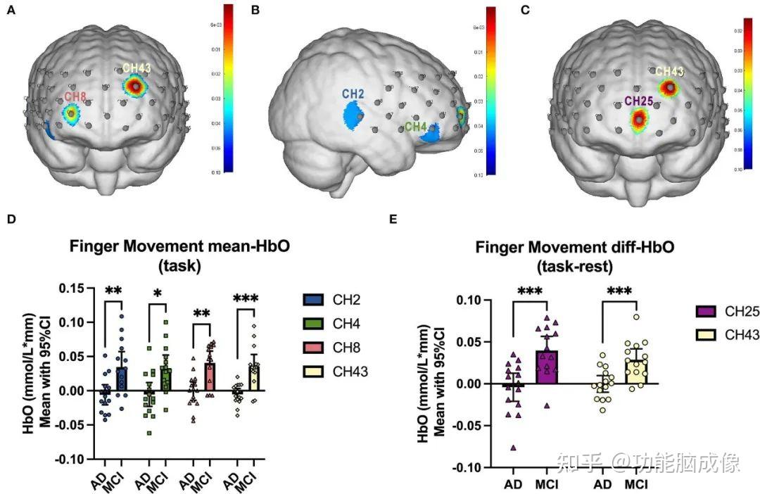 重医附一院吕洋主任团队发脑科学训练SCI论文，慧创fNIRS见证始终！ - 知乎