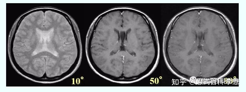 怎样才能更容易理解磁共振梯度回波一系列的序列？ - 知乎