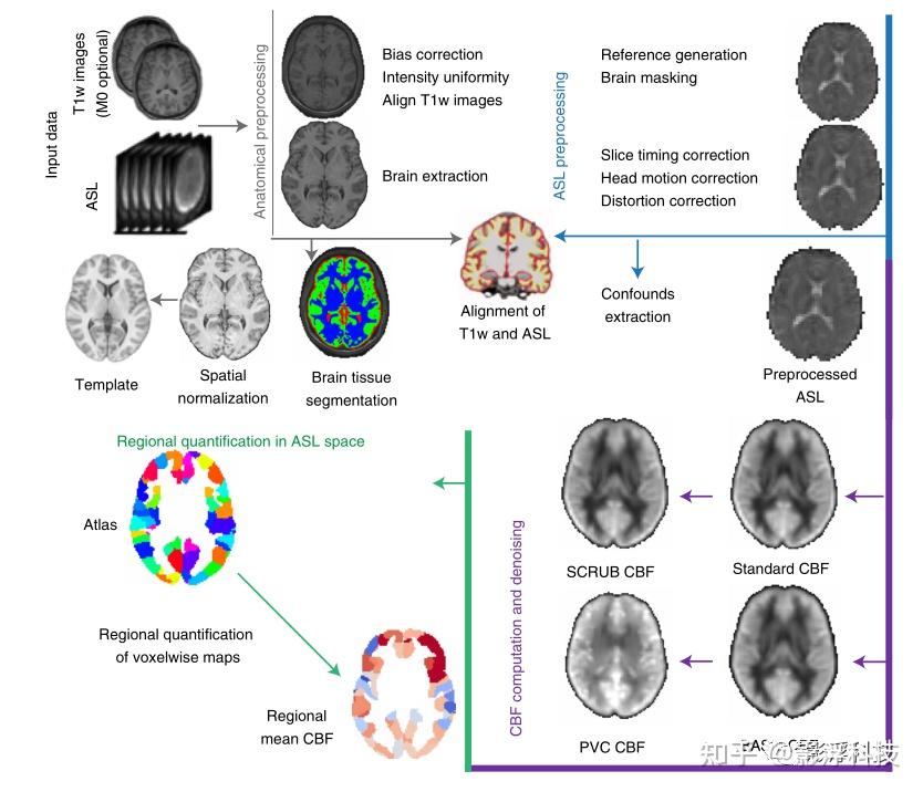2022年第52期(Nature Methods)：ASLPrep——脑血流灌注成像标准化数据分析平台 - 知乎