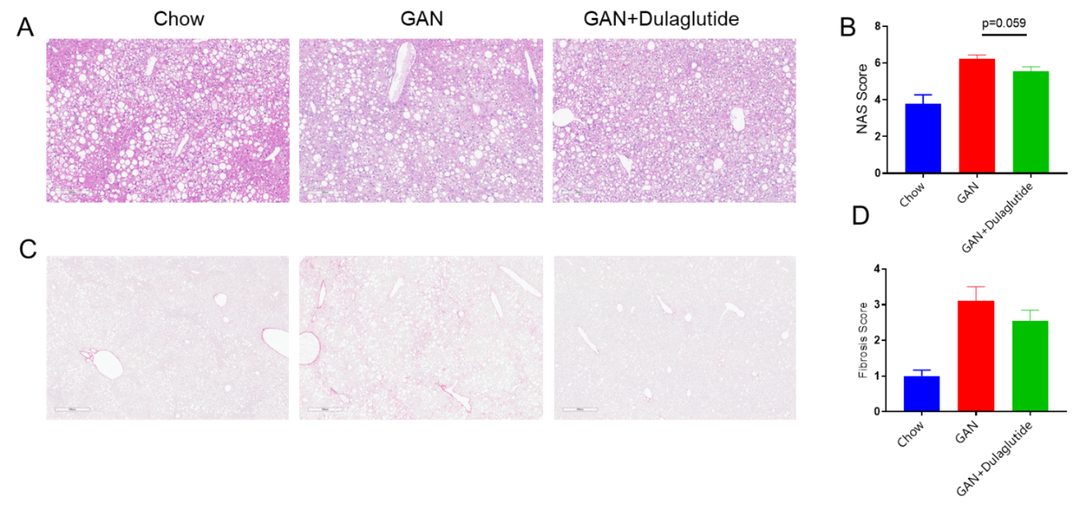 GAN饮食诱导NASH模型 | 老龄鼠再展新风采，助力NASH药物研发 - 知乎