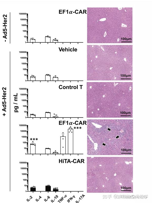 J Immunother Cancer| 低氧诱导的HiTA-CAR-T可能成为新一代的多类型肿瘤"杀手" - 知乎