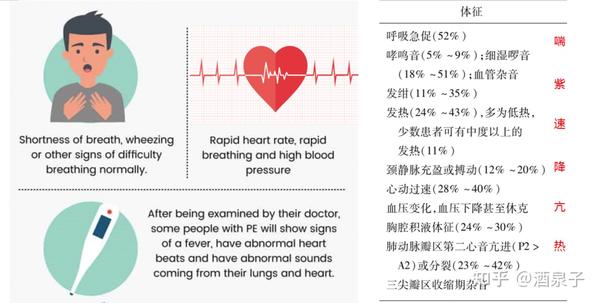 VTE、DVT与PE的关系 - 知乎