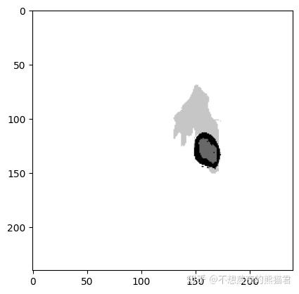 医学图像处理（一）simpleitk打开查看nii图像 - 知乎