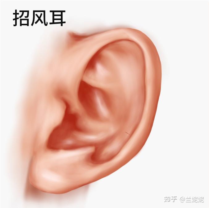 第48期 感觉——耳朵（常见的先天性畸形，多图预警） - 知乎