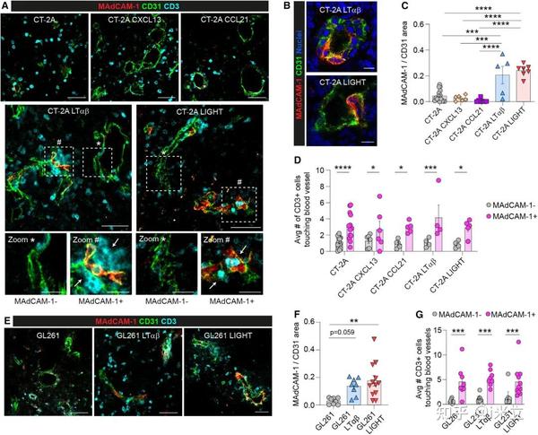 IF:38.585|通过AAV疗法调整血管表型可促进神经胶质瘤的抗肿瘤免疫 - 知乎