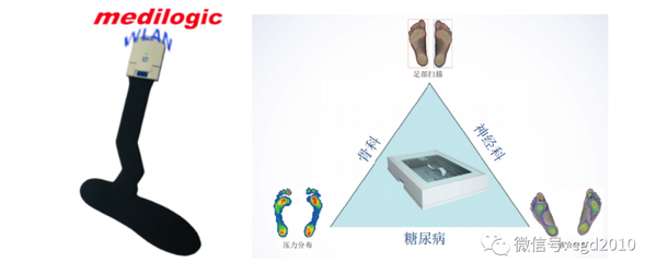 medilogic压力分布测量系统--助力临床诊断和舒适度评估 - 知乎