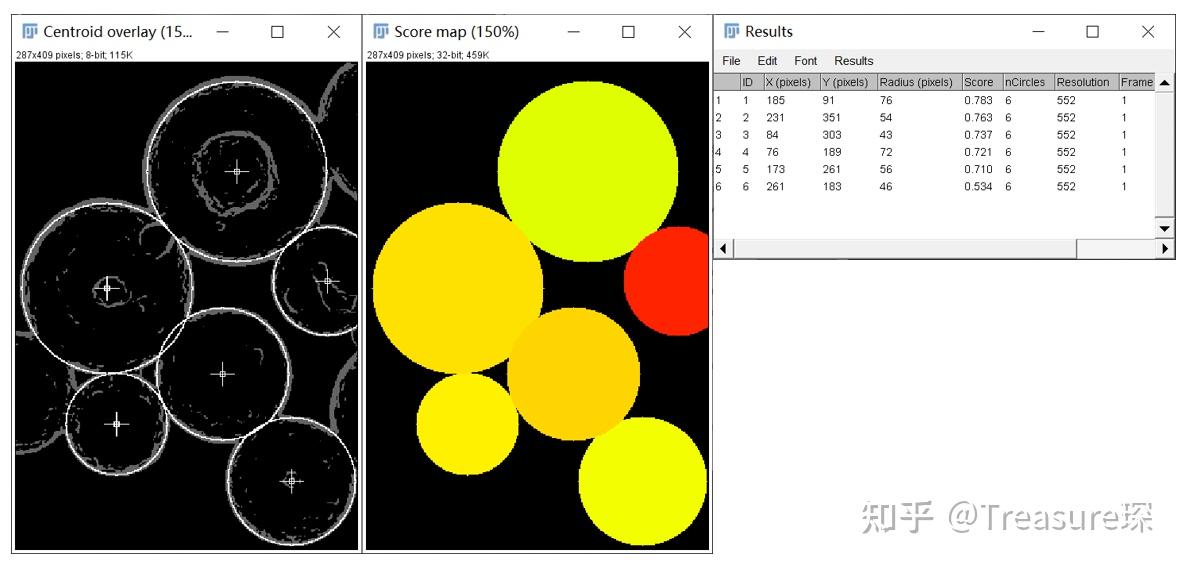 ImageJ实用教程——圆形检测(插件篇) - 知乎