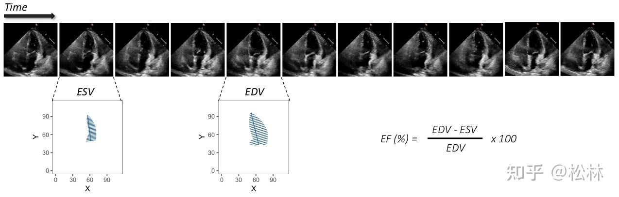 EchoNet-Dynamic: a Large New Cardiac Motion Viedo Data Resource for ...