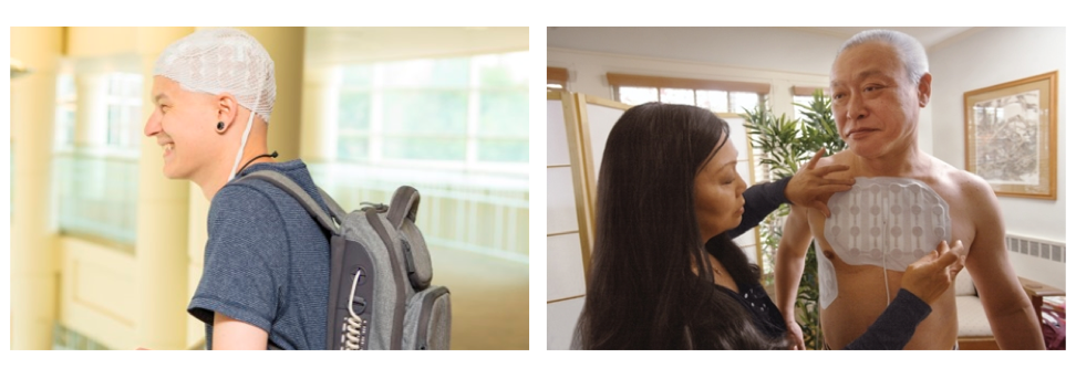 肿瘤电场治疗首次在中国上市！这到底是个啥？ - 知乎