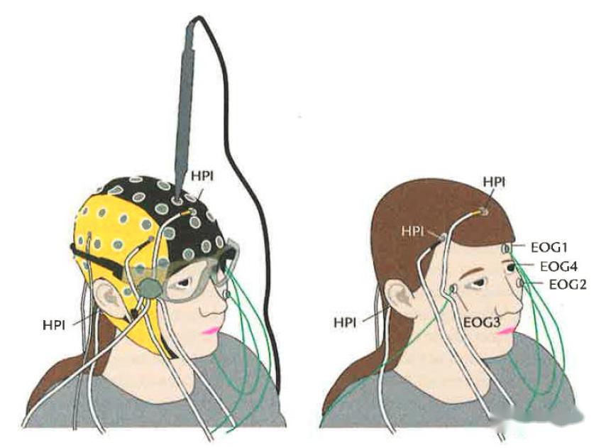 脑磁vs脑电: 两者原来各有所长? - 知乎