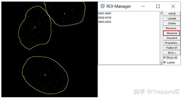 ImageJ实用教程——细胞内荧光点计数(案例分析篇) - 知乎
