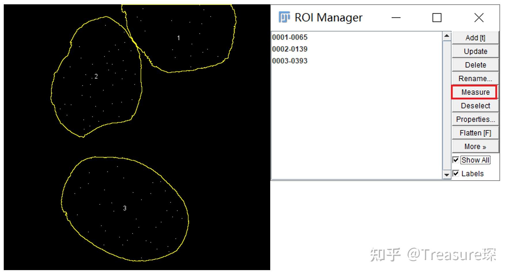 ImageJ实用教程——细胞内荧光点计数(案例分析篇) - 知乎