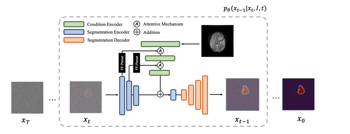 MedSegDiff: Medical Image Segmentation with Diffusion Probabilistic Model（译文） - 知乎