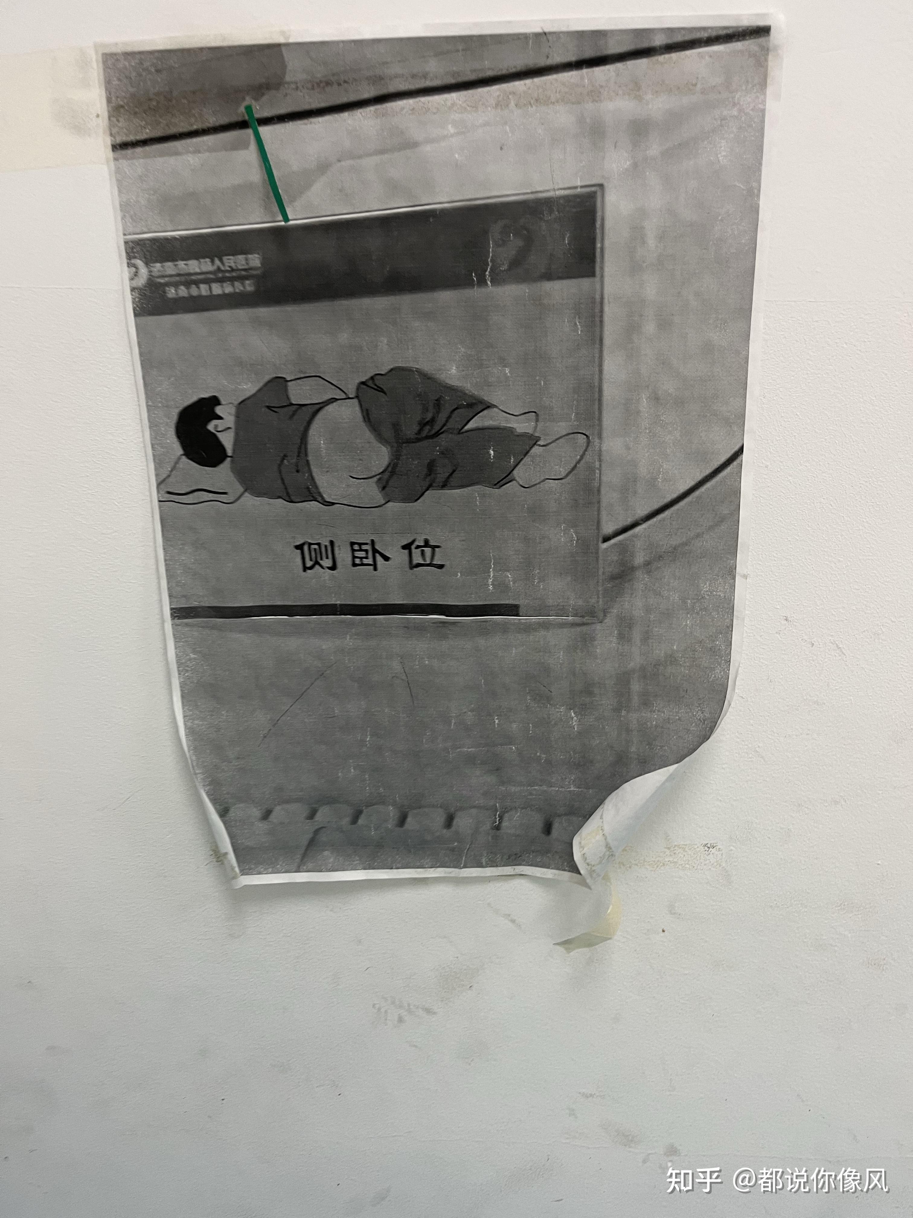 肛门镜和指诊最真实详细的感受,为什么做指诊和肛门镜! 知乎