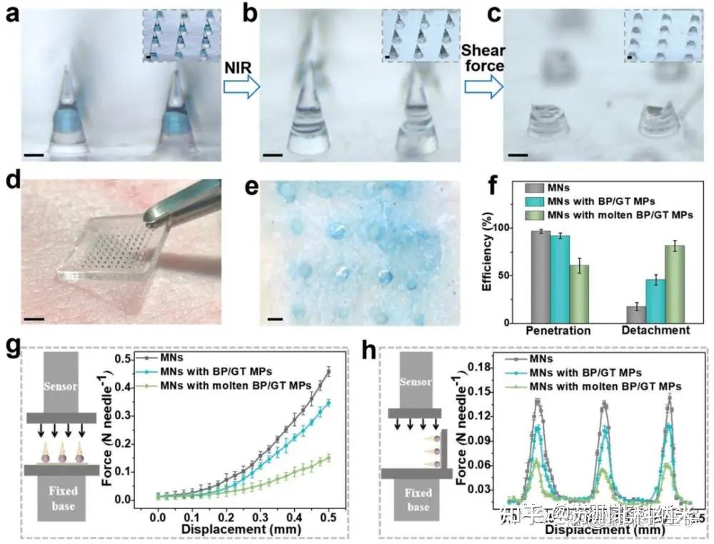 《AFM》：光响应聚合物微针的重要进展 - 知乎