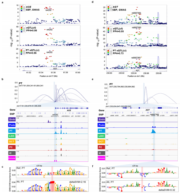 单细胞多组学与eQTL联合分析，确定肾脏疾病的机制和潜在治疗方法 - 知乎