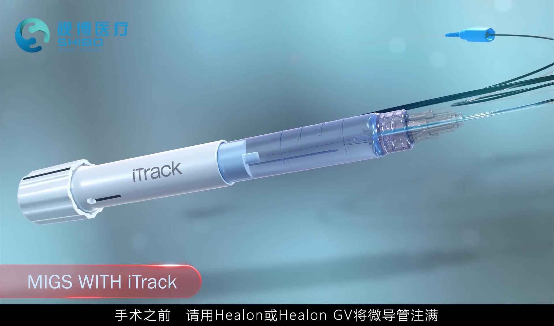 图解：内路粘小管成形术（ABiC），一种微创高效的青光眼手术 - 知乎