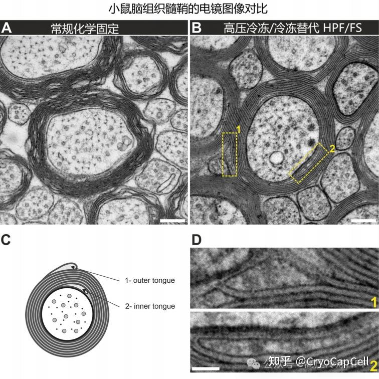 采用高压冷冻/冷冻替代法（HPF/FS）对 CADASIL小血管病脑白质早期超微结构变化的特征研究 - 知乎