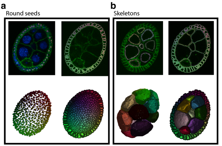 ImageJ实用技巧——3D细胞自动分割(插件篇) - 知乎