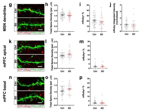 【独家合作】BrainVTA联合北大于翔课题组开发Cre依赖的可标记完整神经元形态的AAV病毒 - 知乎
