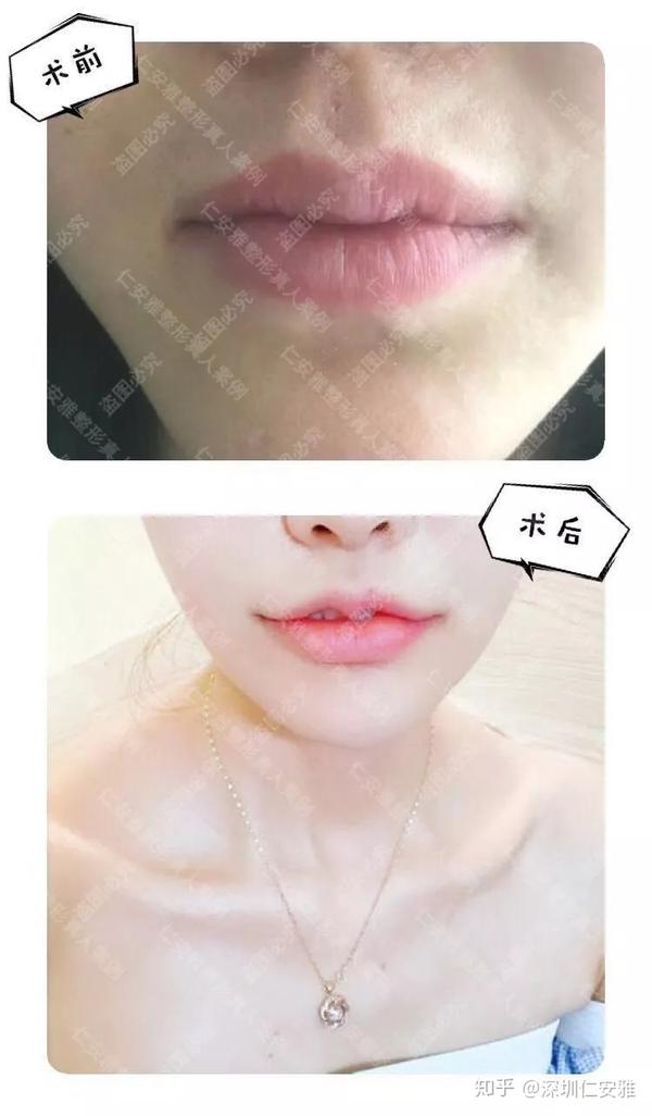 《幸福三重奏》发布会，陈意涵的“花瓣唇”真的超有诱惑力！ - 知乎