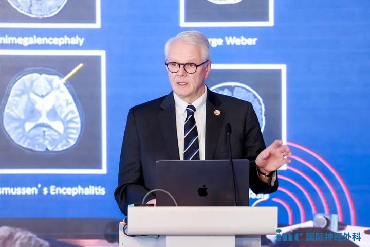 大脑半球切除术攻克难治性癫痫？Rutka教授难治性癫痫30+年经验分享！ - 知乎