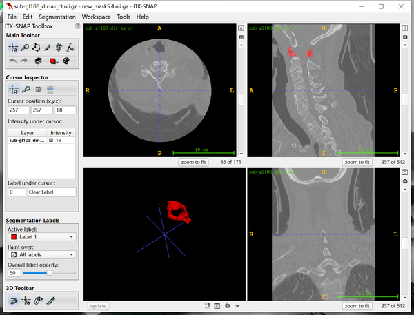 Nii图像处理、投影与生成 - 知乎