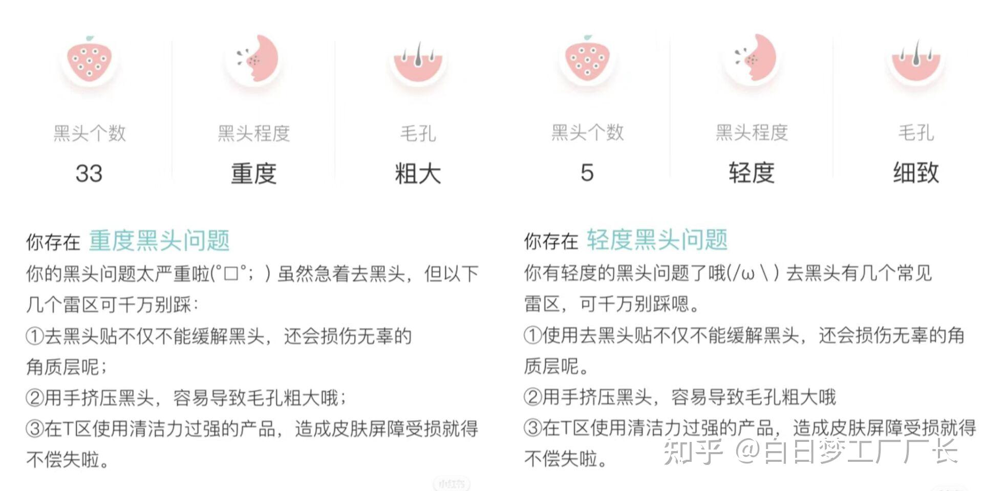 如何更彻底的去除黑头？ 知乎
