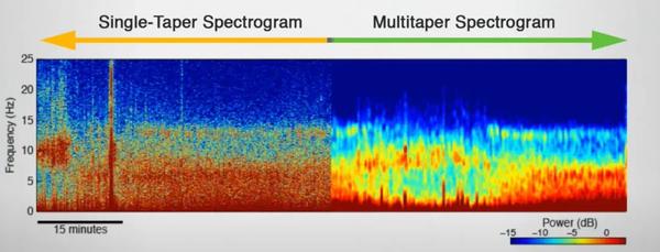 【Lunion Stage】如何使用频谱图提高睡眠分析效率 - 知乎