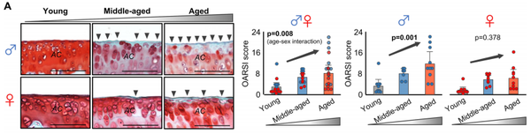 NC（IF17）! 蛋白质组学揭示软骨老化的关键蛋白及相关机制 - 知乎