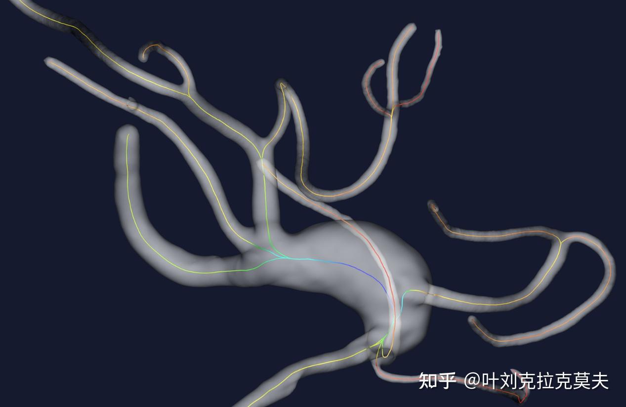 开源科学工程技术软件介绍60 – 血管建模软件VMTK - 知乎