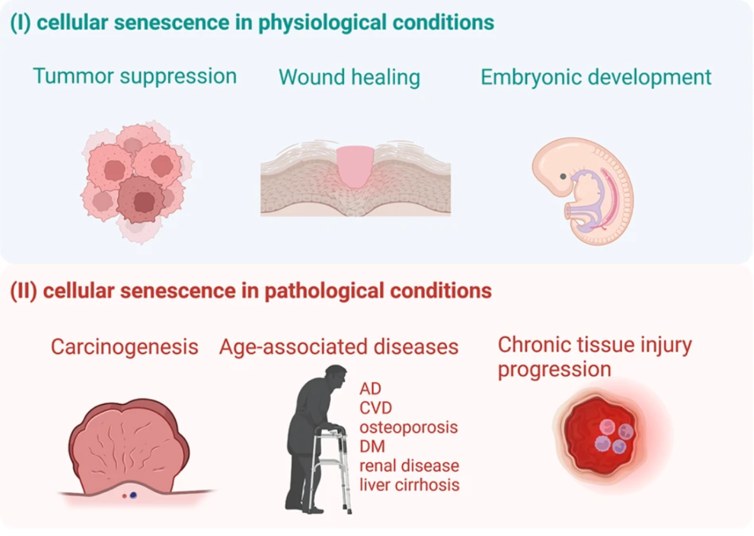 Cell Death Discov 综述︱陈潮金等评述细胞衰老在缺血再灌注损伤中的研究进展 - 知乎