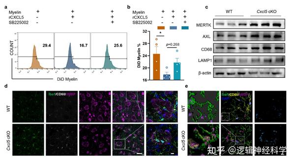J Neuroinflammation︱南京大学医学院附属鼓楼医院徐运/邱树卫团队揭示星形胶质细胞源性CXCL5在慢性缺血性脑白质损伤中的作用 ...