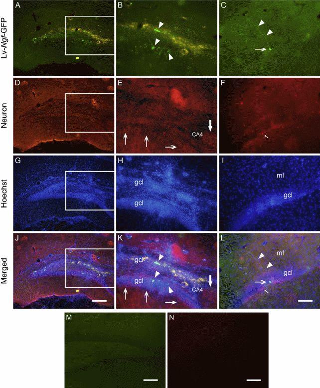 基因传递工具 | 一文了解慢病毒的应用全场景 - 知乎