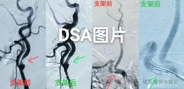 什么是DSA?与CTA有何区别？ - 知乎
