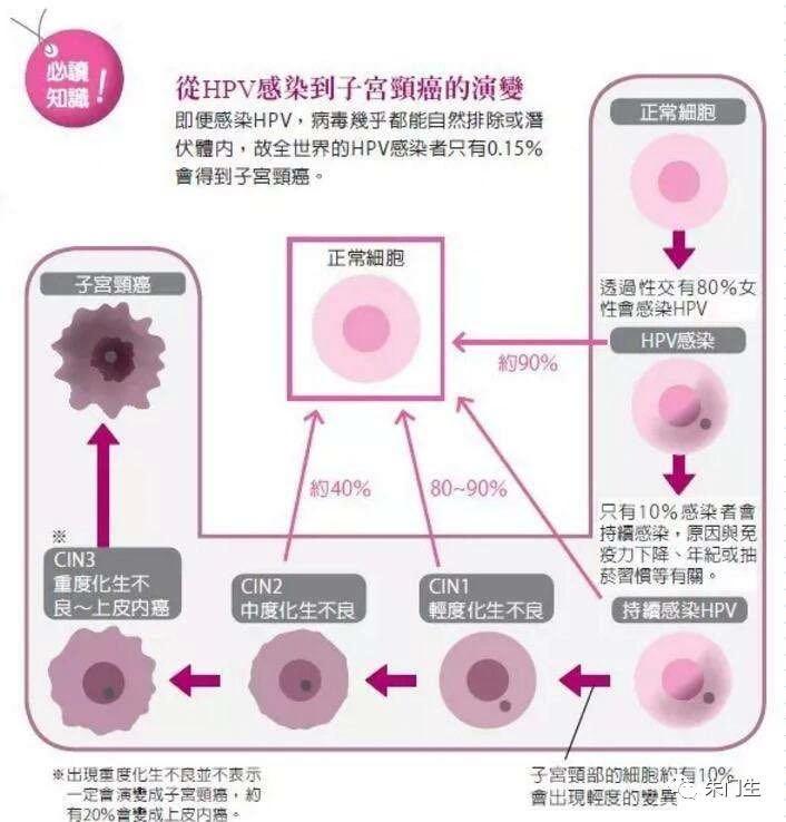 Hpv如何演变为宫颈癌 知乎