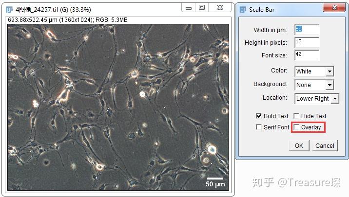 ImageJ实用技巧——比例尺设置和批量添加(基本功能篇) - 知乎