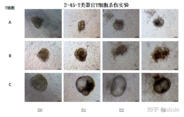 类器官与PBMC共培养实验方案，超实用！不信还学不会 - 知乎