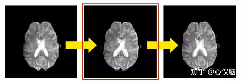 利用FSL进行核磁数据处理(使用GUI/代码) - 知乎