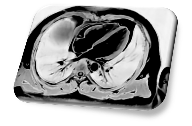MRI 的ECG解读 - 知乎