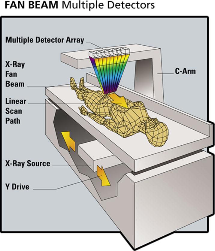 是时候说一下「骨密度检查」（DXA）了 - 知乎
