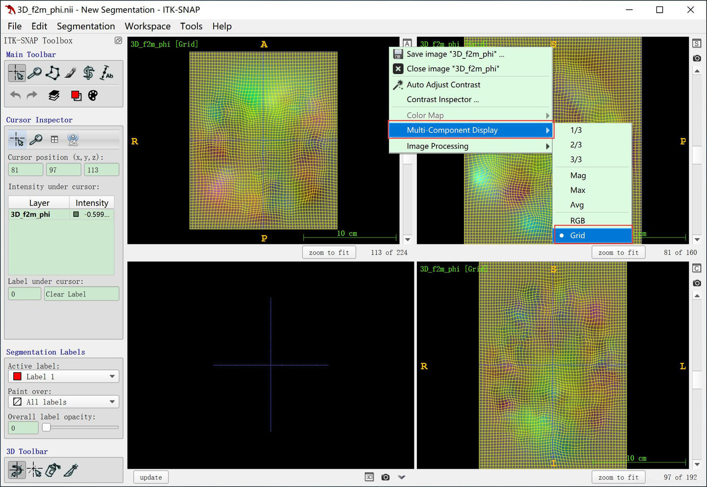 [论文笔记] VoxelMorph - 知乎