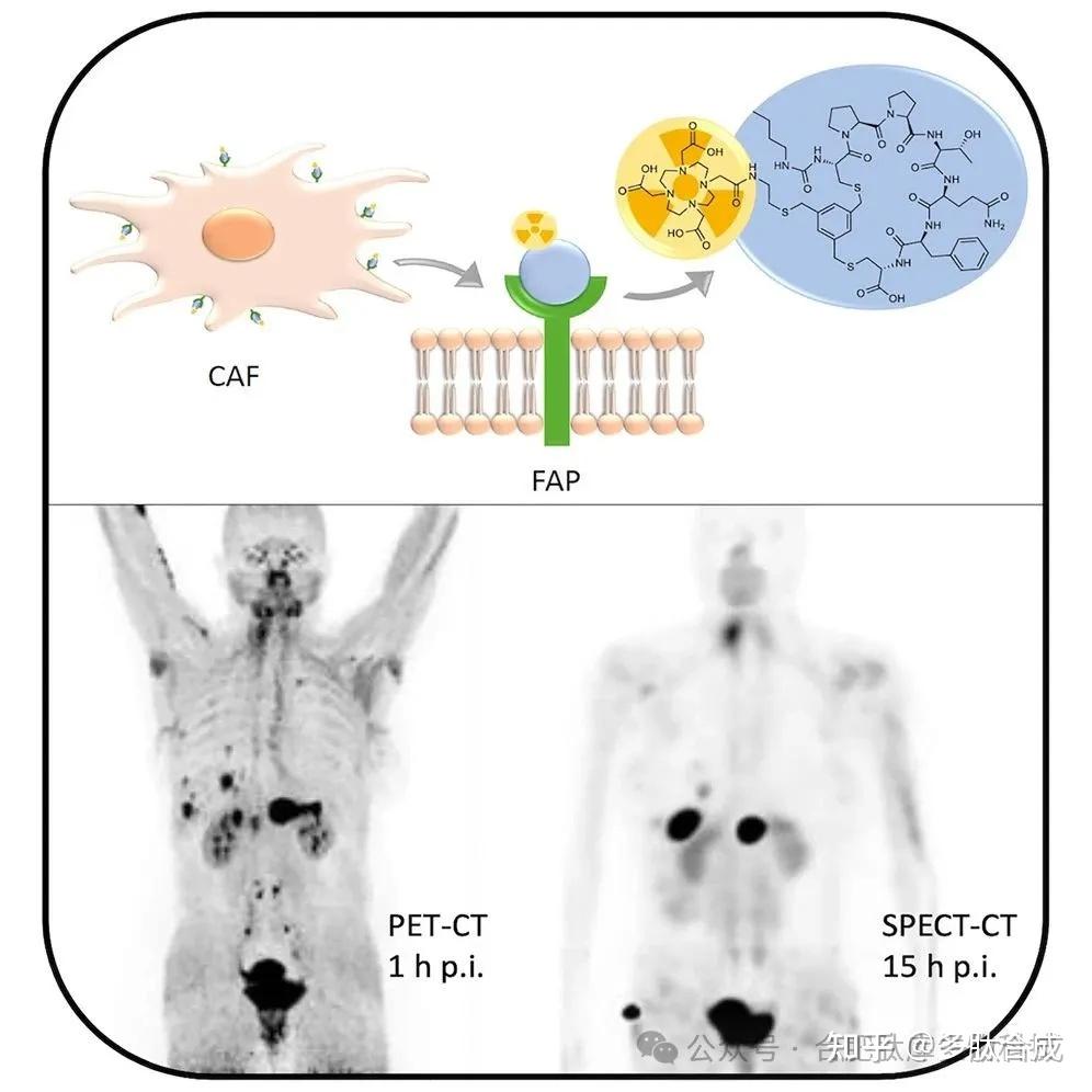 3BP-3940：一种用于诊疗一体化的高度有效的成纤维细胞活化蛋白靶向肽 - 知乎