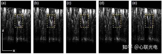 Opt. Lett.：液体变焦镜头结合OCTA进行小鼠大脑深层皮质血流成像 - 知乎
