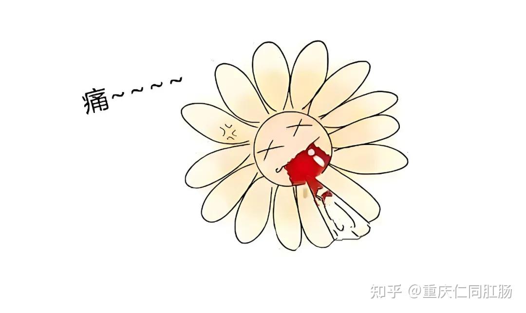 重庆哪家医院的肠肛门好痔疮做手术一般需要住几天医院 知乎 8978
