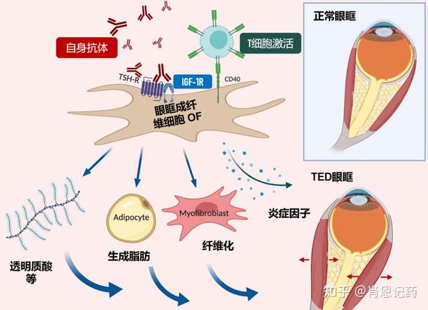 记住治疗甲状腺眼病生物药 | Teprotumumab 替妥木单抗 | 胰岛素样生长因子1受体（IGF-1R）拮抗剂 - 知乎