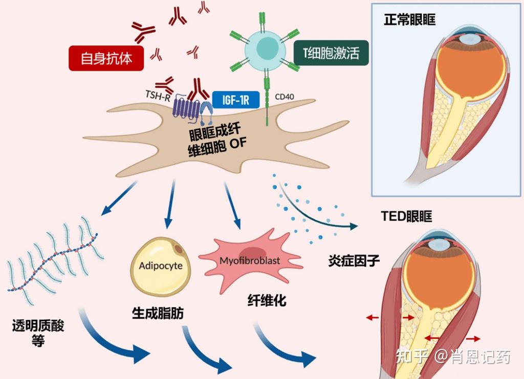 记住治疗甲状腺眼病生物药 | Teprotumumab 替妥木单抗 | 胰岛素样生长因子1受体（IGF-1R）拮抗剂 - 知乎
