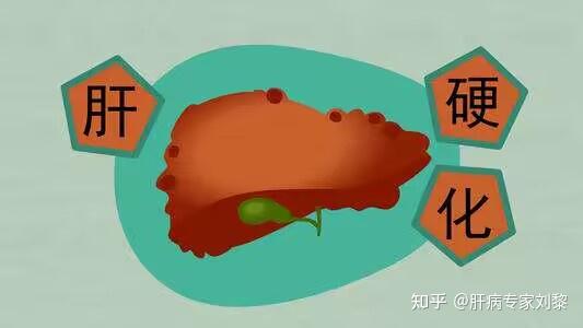 肝硬化进入失代偿期，是不是离肝癌不远了？ 知乎