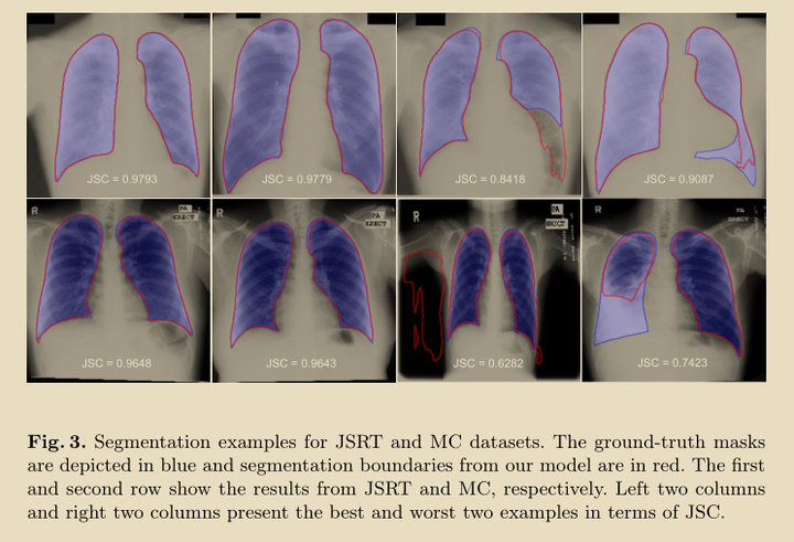 Accurate Lung Segmentation via Network-Wise Training of Convolutional ...